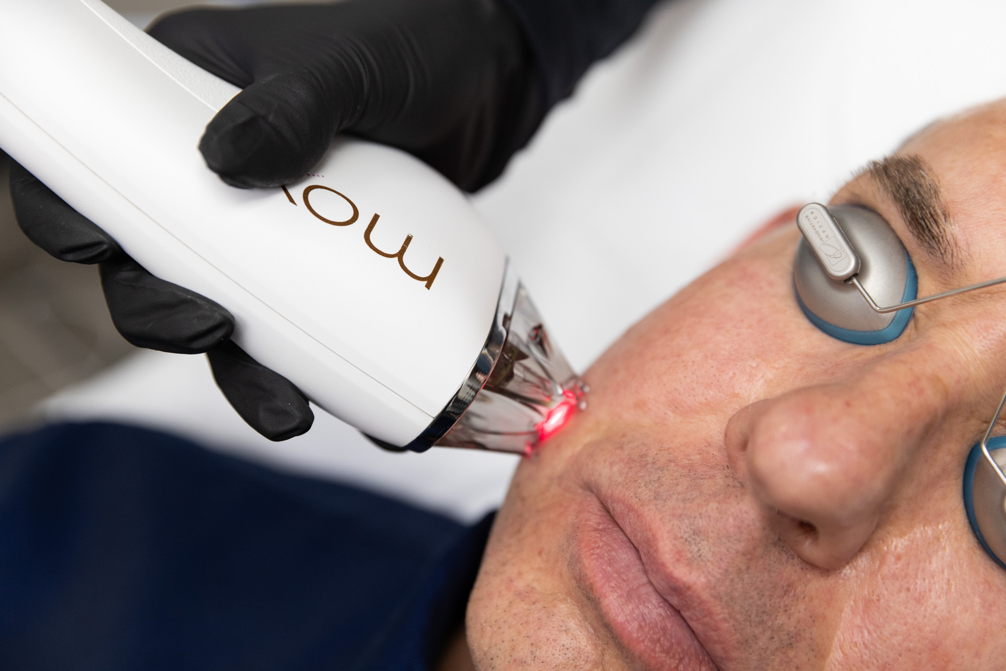 Moxi - Innovative Dermatology